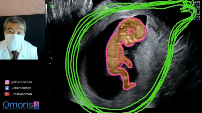 11 Semanas e 2 Dias: O Que Esperar Durante a Gravidez | Actualizado ...