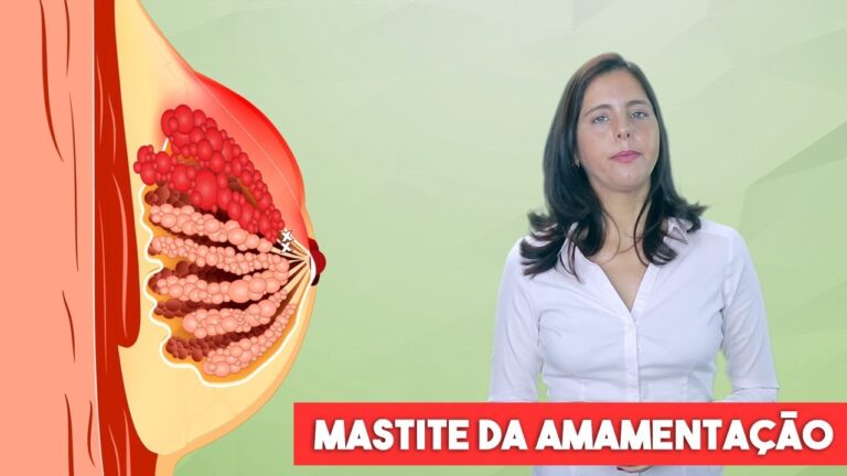 Autocuidados para Mastite: Dicas e Orientações | Actualizado septiembre ...
