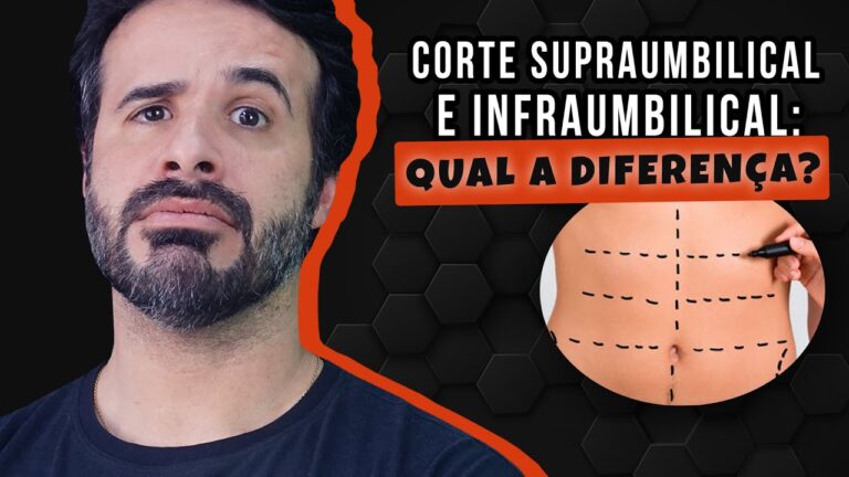 Explorando a Linha Infraumbilical: Funções e Importância | Actualizado ...