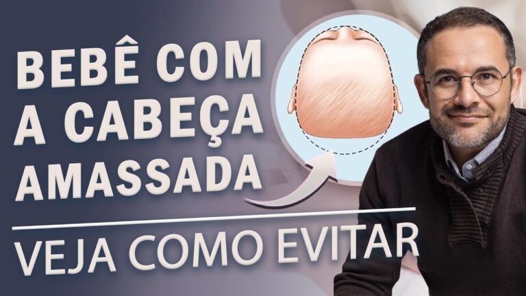 Como lidar com um bebê de testa alta: dicas e cuidados | Actualizado ...